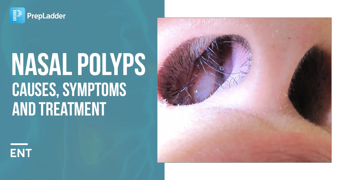 Nasal Polyps Pictures Online Nasal Polyps Pictures Online