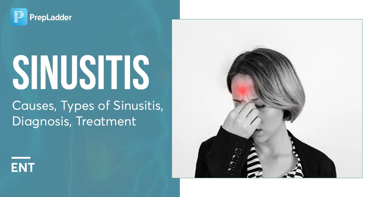 Sinusitis Causes Types Of Sinusitis Diagnosis Treatment
