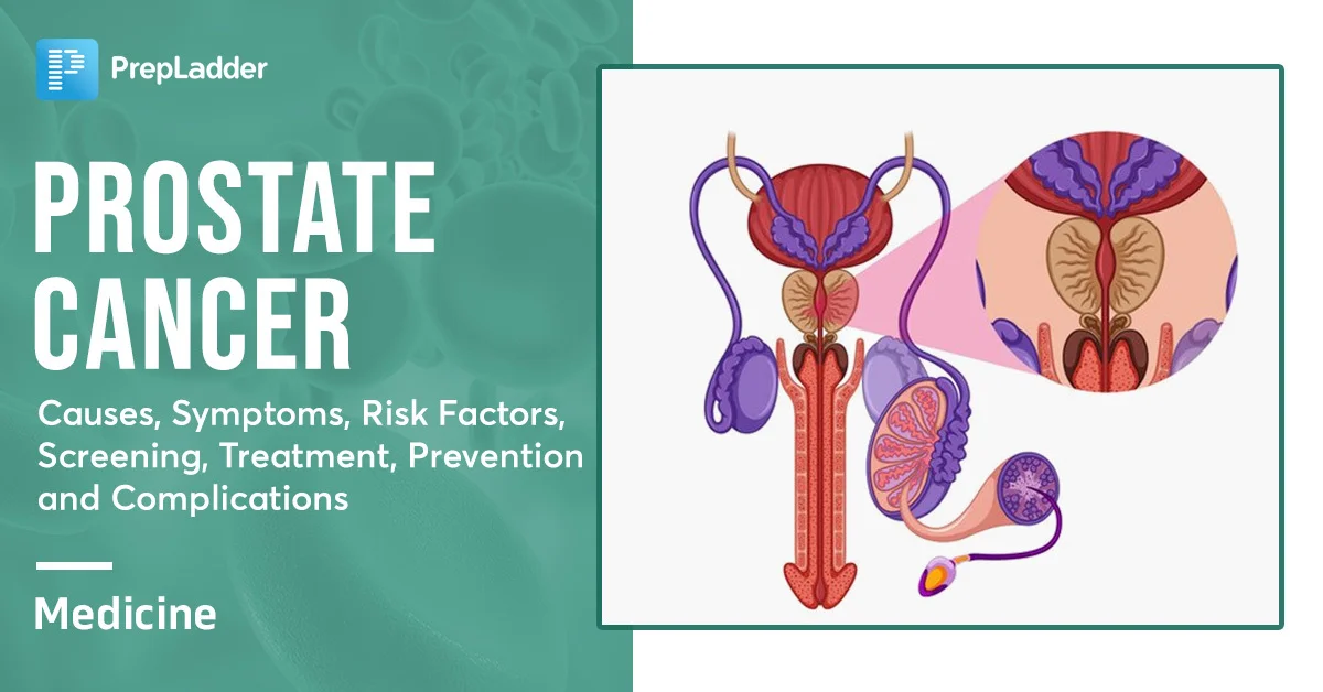 Prostate Cancer Causes Symptoms Treatment Complications