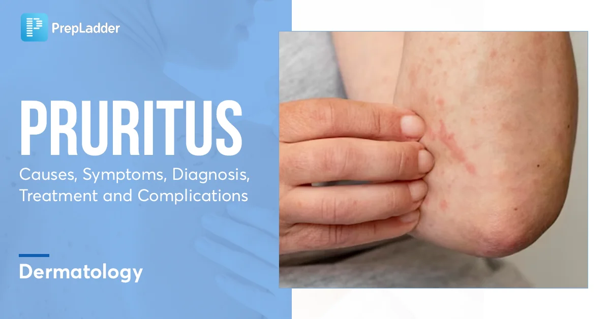 Causes And Treatment Of Pruritus Itchy Skin Uraemic Pruritus Renal Causes And Treatment Of Pruritus Itchy Skin Uraemic Pruritus Renal