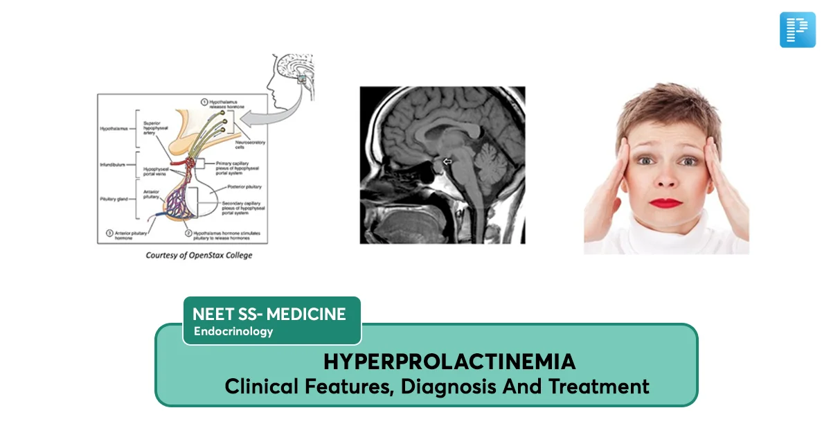 Hyperprolactinemia – Clinical Features, Diagnosis & Management