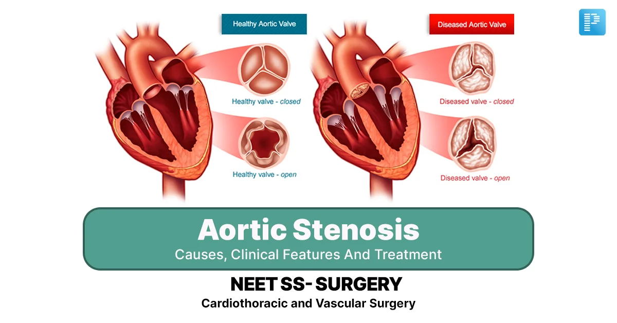 Aortic Regurgitation Causes Investigation Clinical Features