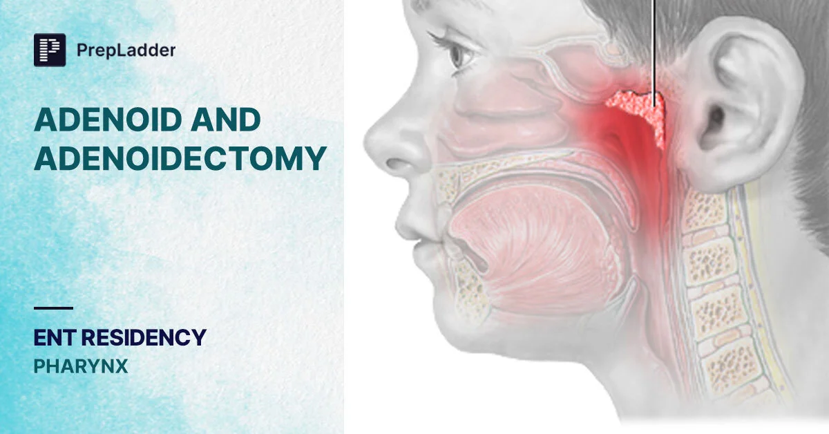 Adenoids Adenoidectomy Adenoid Removal Childrens Minnesota Adenoids Adenoidectomy Adenoid Removal Childrens Minnesota