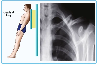 Special X- ray Views in Orthopedics for NEET PG- PrepLadder